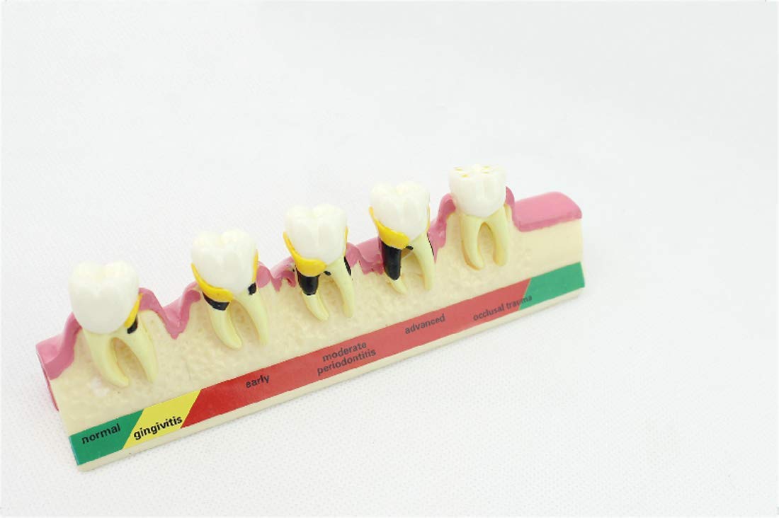 Buy Educational Model Oral Anatomy Teaching of Anatomical Model of ...