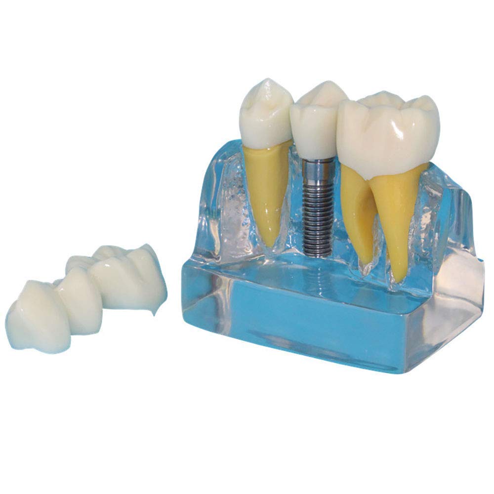 Buy YZ-YUAN Assembly Dental Tooth Im Model, Anatomical Oral Model Adult ...
