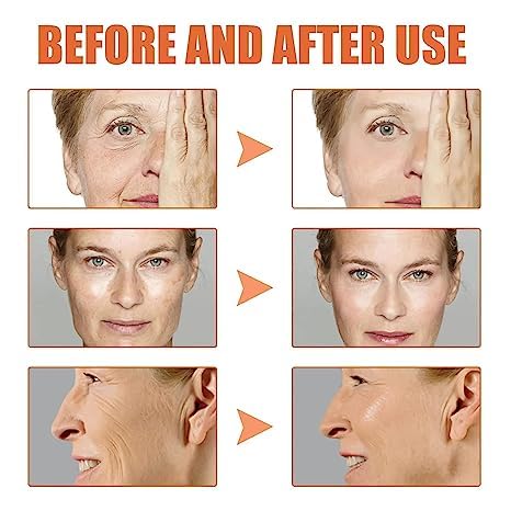Botox Stock Solution Facial Serum,Botox Stock Solution ...
