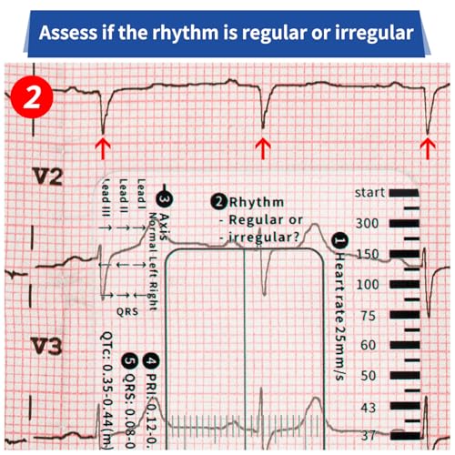 Regla de ECG, regla de ECG de 2 piezas con la interpretación de ECG/ECG ...