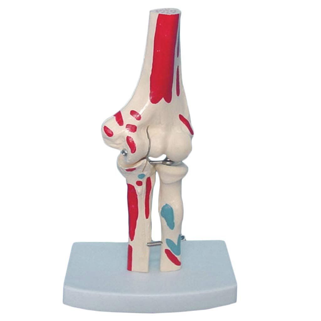 Buy Educational Model Elbow Joint Model - Anatomical Human Elbow Joint ...