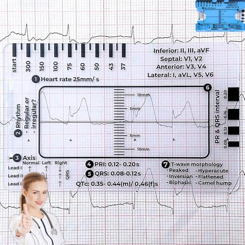 Règle ECG 7 étapes, règle ECG 7 étapes pour interprétation ECG/ECG ...