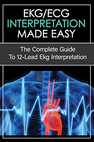 Amazon.com: Ekg/Ecg Interpretation Made Easy: The Complete Guide To 12 ...