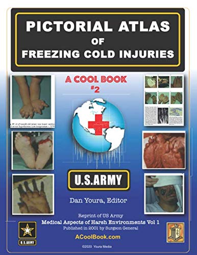 Pictorial Atlas of Freezing Cold Injuries: A Cool Book #2 | Amazon.com.br