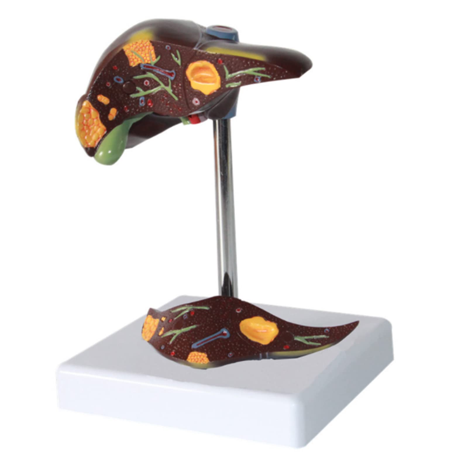 Buy Body Model Liver Pathology Model Anatomical Pathology Model of ...