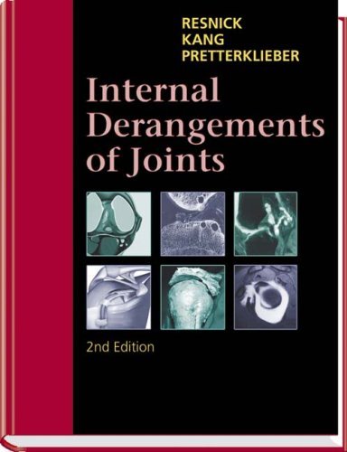 By Donald L. Resnick - Internal Derangements of Joints: 2-Volume Set ...
