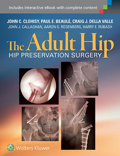 The Adult Hip: Hip Preservation Surgery: 9781451183931: Medicine ...