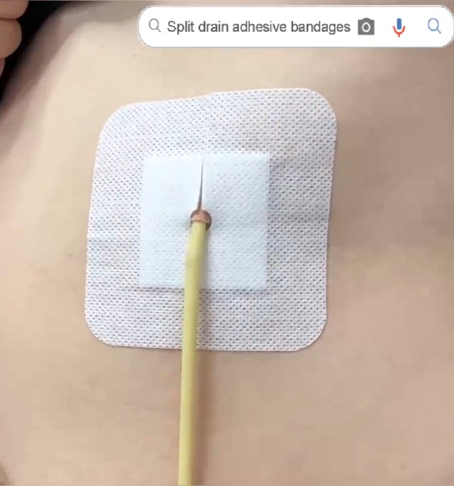 Watch Split Drain Adhesive Bandages Feeding Tube Pad on Amazon Live