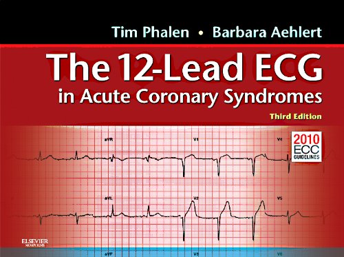 12-Lead ECG in Acute Coronary Syndromes: Tim Phalen, Barbara Aehlert: 9780323080637: Amazon.com ...