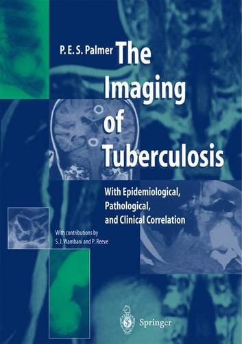 The Imaging of Tuberculosis: With Epidemiological, Pathological and ...