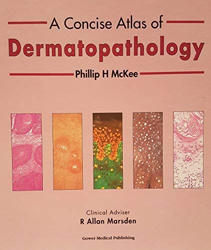A Concise Atlas of Dermatopathology: 9781563755743: Medicine & Health ...