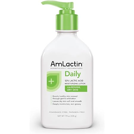 Amazon.com : Major Pharmaceuticals Ammonium Lactate Lotion 12% 396 g ...