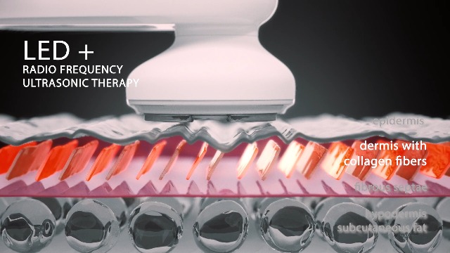 Watch 3 in 1 Slimming Therapy Body Shaping Device on Amazon Live