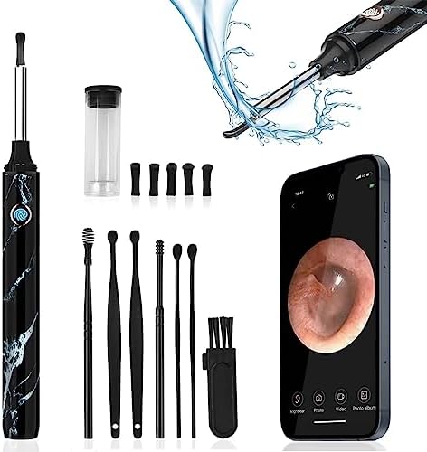 Amazon.com: Ear Wax Removal, Ear Camera with 1080P, Ear Cleaner with ...