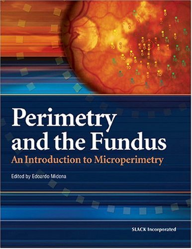 Perimetry And The Fundus An Introduction To Microperimetry | Desertcart ...
