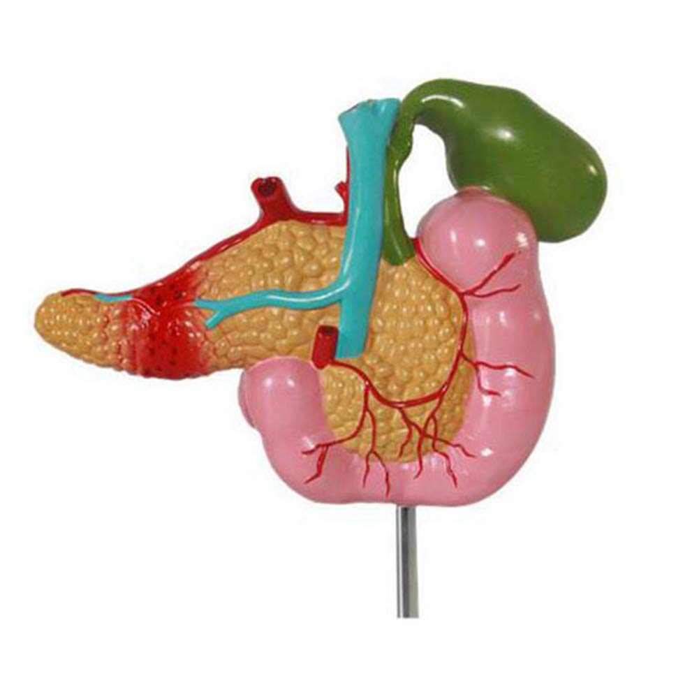 JL Viscera Pathological Model Pancreatic Duodenum Gallbladder Pathology ...