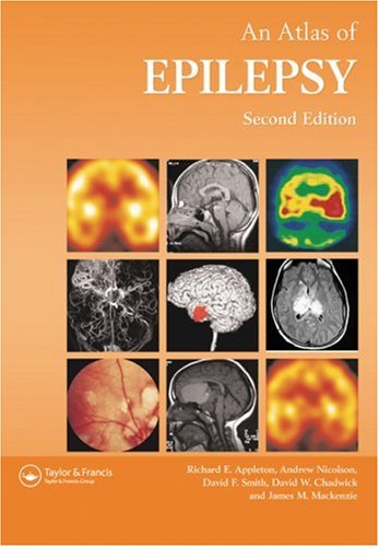 Atlas of Epilepsy: 9781842140277: Medicine & Health Science Books ...