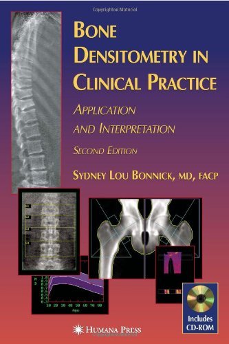 Bone Densitometry in Clinical Practice: Application and Interpretation ...