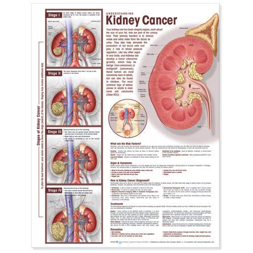 Understanding Kidney Cancer Anatomical Chart : Anatomical Chart Company ...