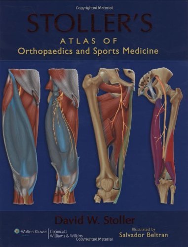 Amazon.co.jp: By David W. Stoller - Stoller's Atlas of Orthopaedics and ...