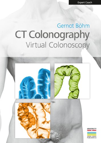 Amazon.com: CT-Colonography Virtual Colonoscopy eBook : Böhm, Gernot: Books