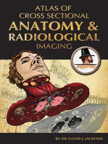 Buy Atlas Of Cross Sectional Anatomy And Radiological Imaging (Hb 2013 ...