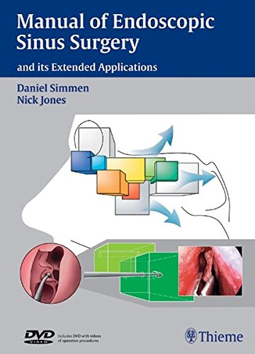 Endoscopic Sinus Surgery - And Extended Applications: Daniel Simmen ...