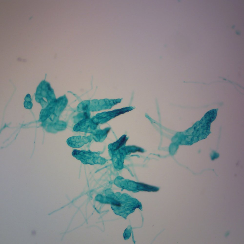 Fern Prothallium Filamentous