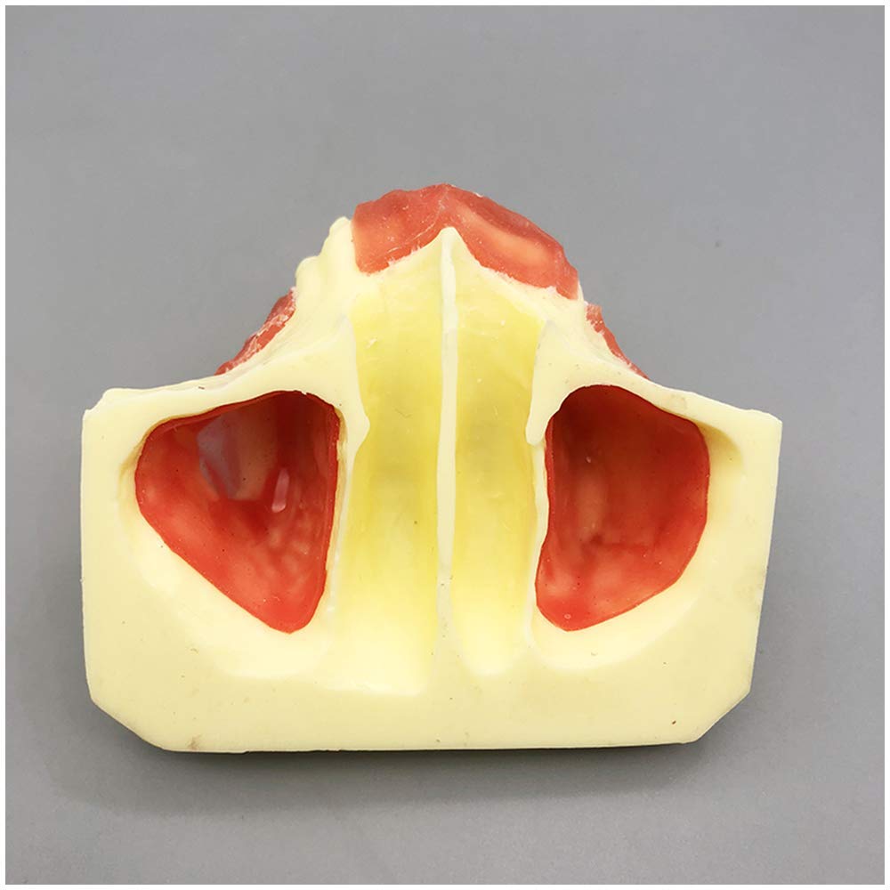 Sinus Sinus Maxillary Dental Tooth Study Template Oral Tooth Implant ...