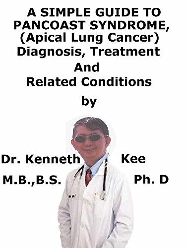 A Simple Guide To Pancoast Syndrome, (Apical Lung Cancer) Diagnosis ...