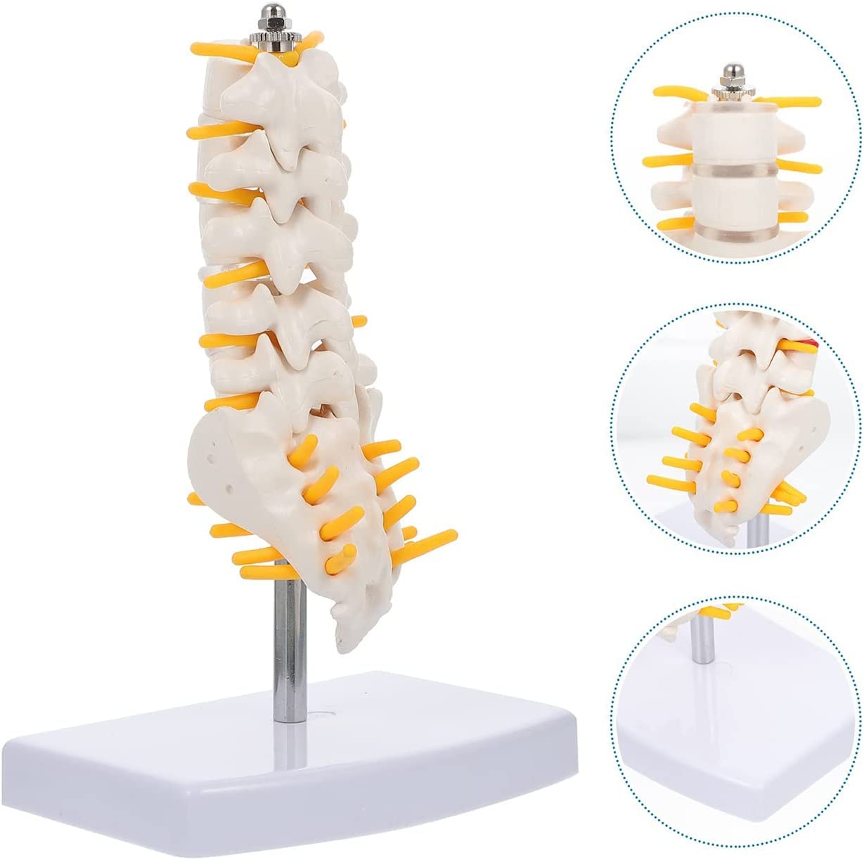 Spinal Nerves And Herniation Model Life-Size Transparent Lumbar Spine ...
