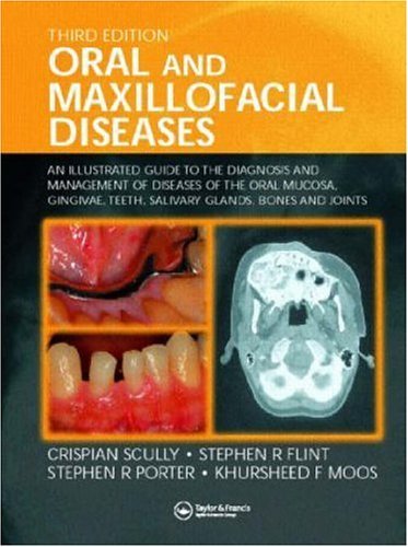 Oral and Maxillofacial Diseases: An Illustrated Guide to the Diagnosis ...
