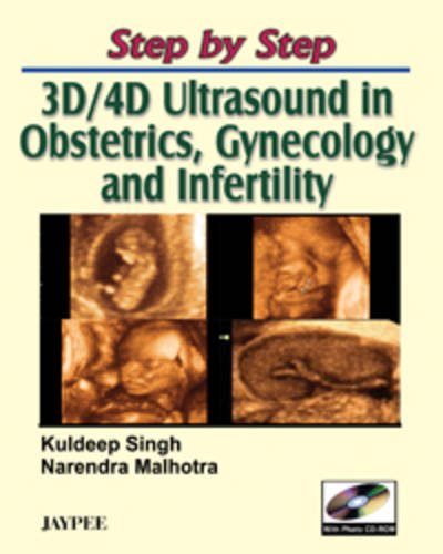 Step by Step: 3D and 4D Ultrasound in Obstetrics, Gynecology and ...