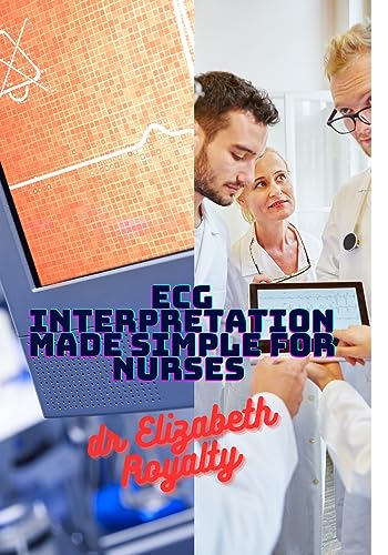 ECG interpretation made simple for nurses : The nurse's guide to ECG ...