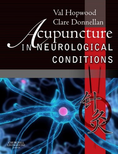 Amazon.com: Acupuncture in Neurological Conditions eBook : Hopwood, Val ...