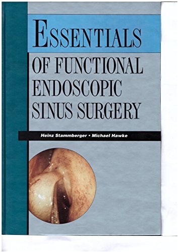Essentials Of Functional Sinus Surgery: 9781556643866: Medicine ...