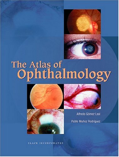 The Atlas of Ophthalmology: Buy Online at Best Price in Egypt - Souq is ...
