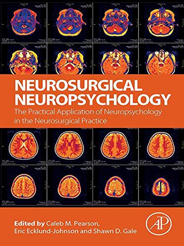 20 Best Neurosurgery Books of All Time - BookAuthority