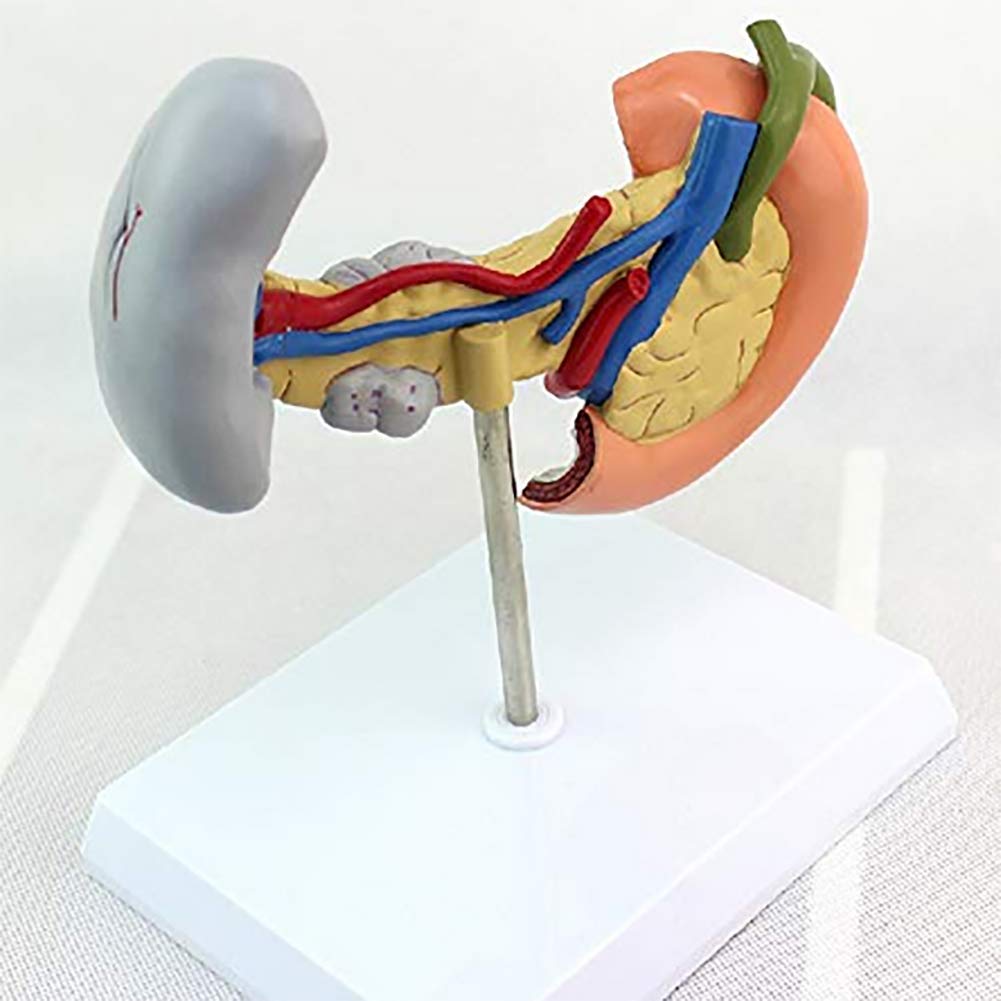 Buy ZQDL Anatomical Model Pancreatic Duodenal Gallbladder Pathological ...
