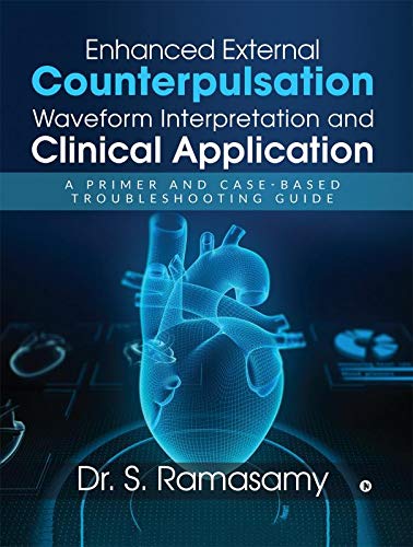 Buy Enhanced External Counterpulsation Waveform Interpretation and ...
