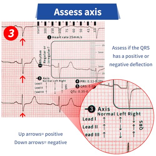 Regla de ECG, regla de ECG de 2 piezas con la interpretación de ECG/ECG ...