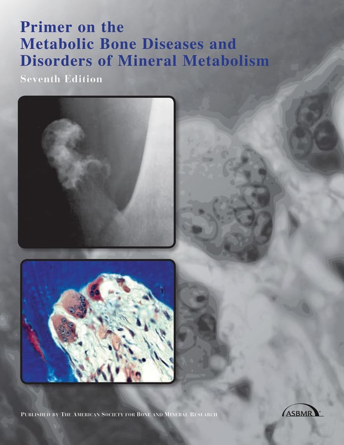 Primer on the Metabolic Bone Diseases And Disorders of Mineral ...
