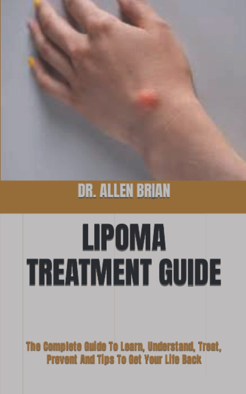 Buy LIPOMA GUIDE: The Complete Guide To Learn, Understand, Treat ...