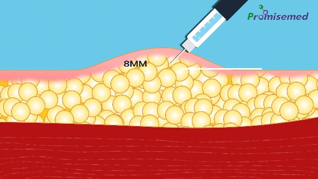 Watch How to choose and use insulin pen needles on Amazon Live