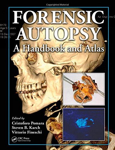 Forensic Autopsy: A Handbook and Atlas: 9781439800645: Medicine ...