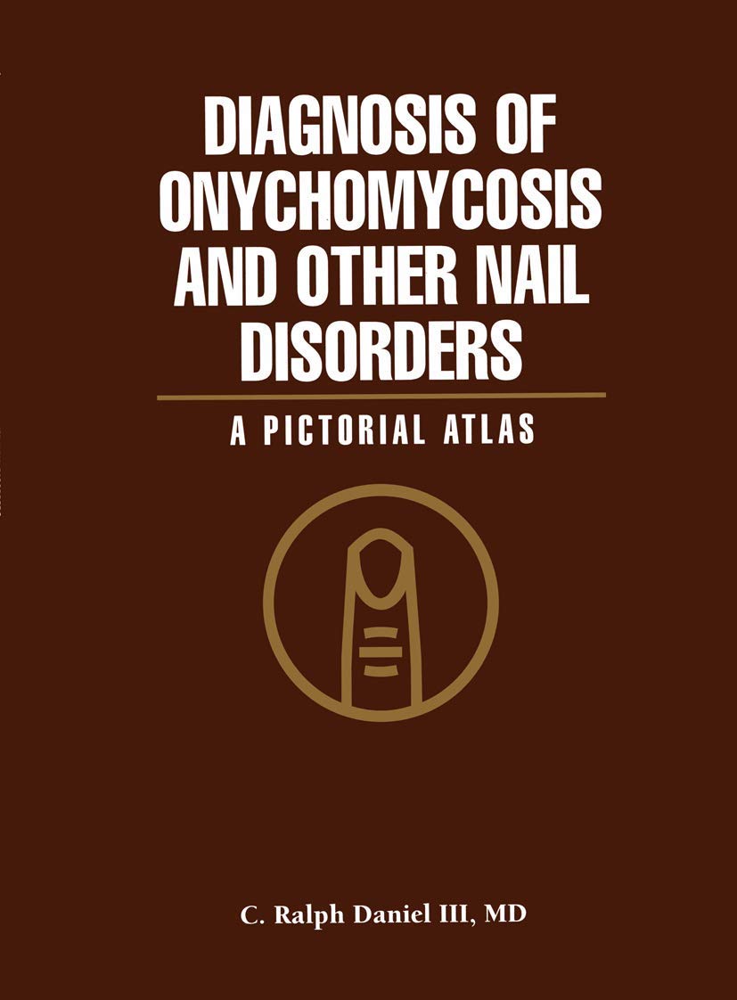 Diagnosis of Onychomycosis and Other Nail Disorders: A Pictorial Atlas ...