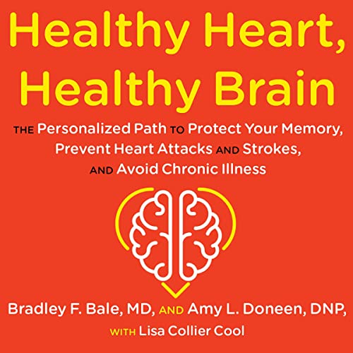 Amazon.com: The Simple Heart Cure: The 90-Day Program to Stop and ...