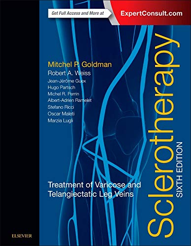 Sclerotherapy: Treatment of Varicose and Telangiectatic Leg Veins ...
