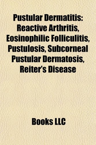Pustular Dermatitis: Reactive Arthritis, : Llc, Books: Amazon.es: Libros