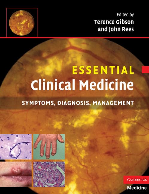 Essential Clinical Medicine: Symptoms, Diagnosis, Management (Essential ...
